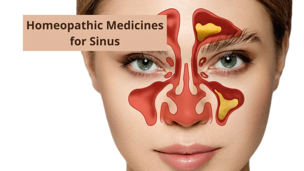 10 Best Homeopathic Medicine For Sinus